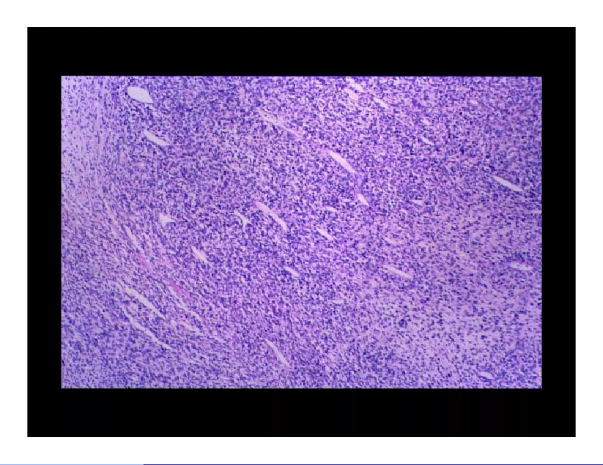 Bone and soft tissue pathology | PPT Bone and soft tissue pathology | PPT