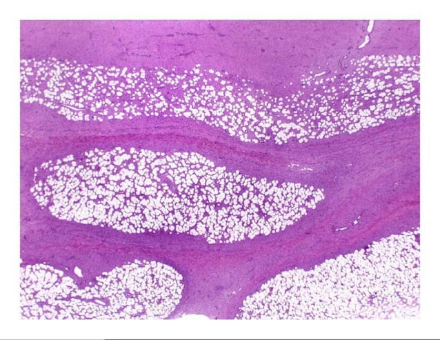 Bone and soft tissue pathology | PPT Bone and soft tissue pathology | PPT