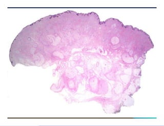 Bone and soft tissue pathology | PPTX