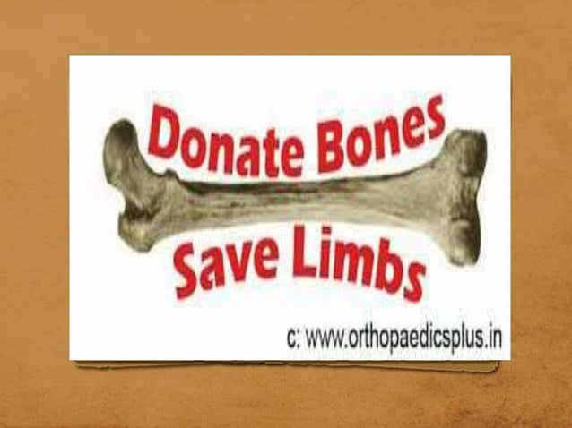 Bone bank presentation | PPTX