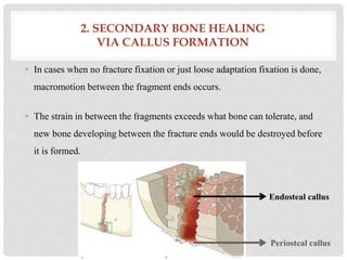 Bone biology and bone healing | PPTX | Bone and Joint Conditions ...