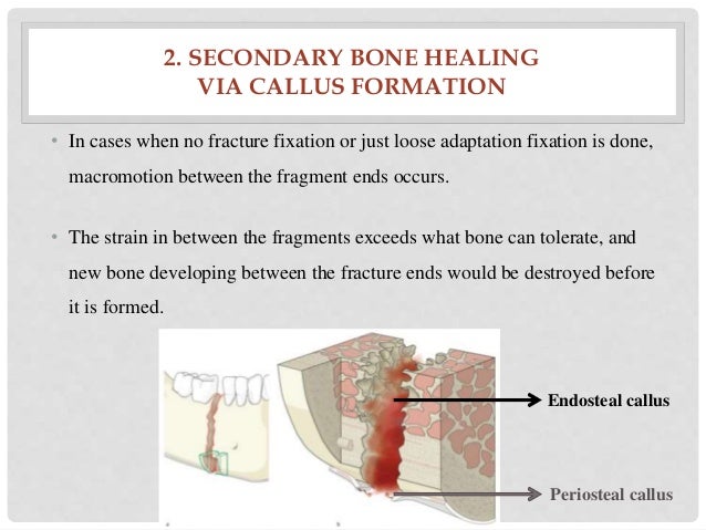 Bone biology and bone healing