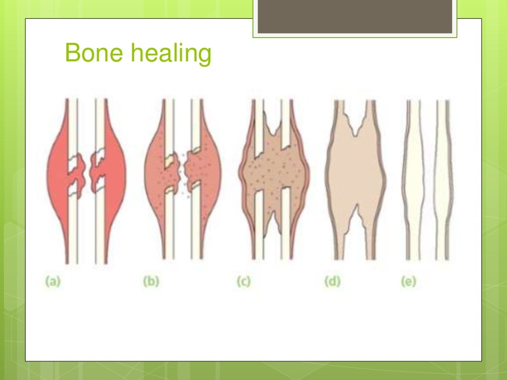 Bone biology, healing and biomechanics