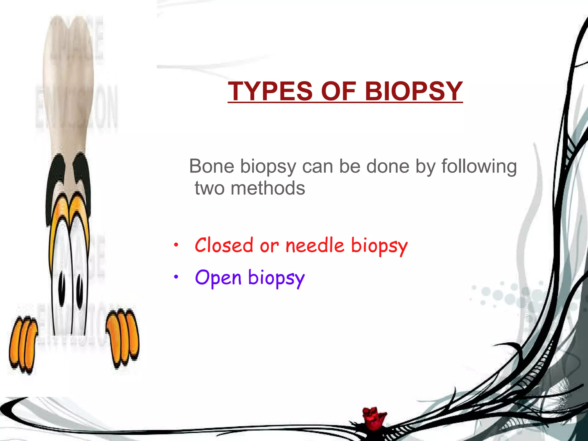 Bone Biopsy And Its Decalcification | PPT