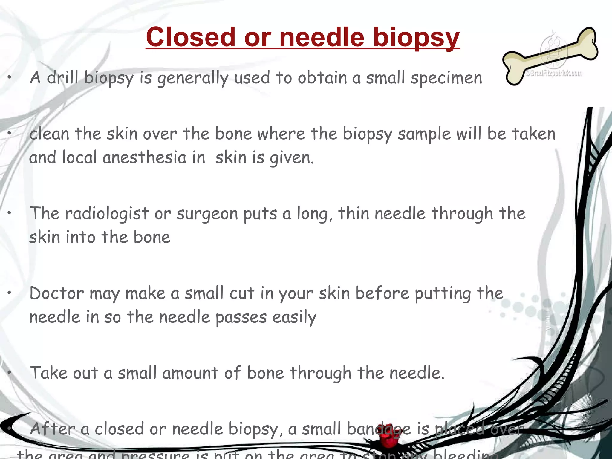 Bone Biopsy And Its Decalcification | PPT