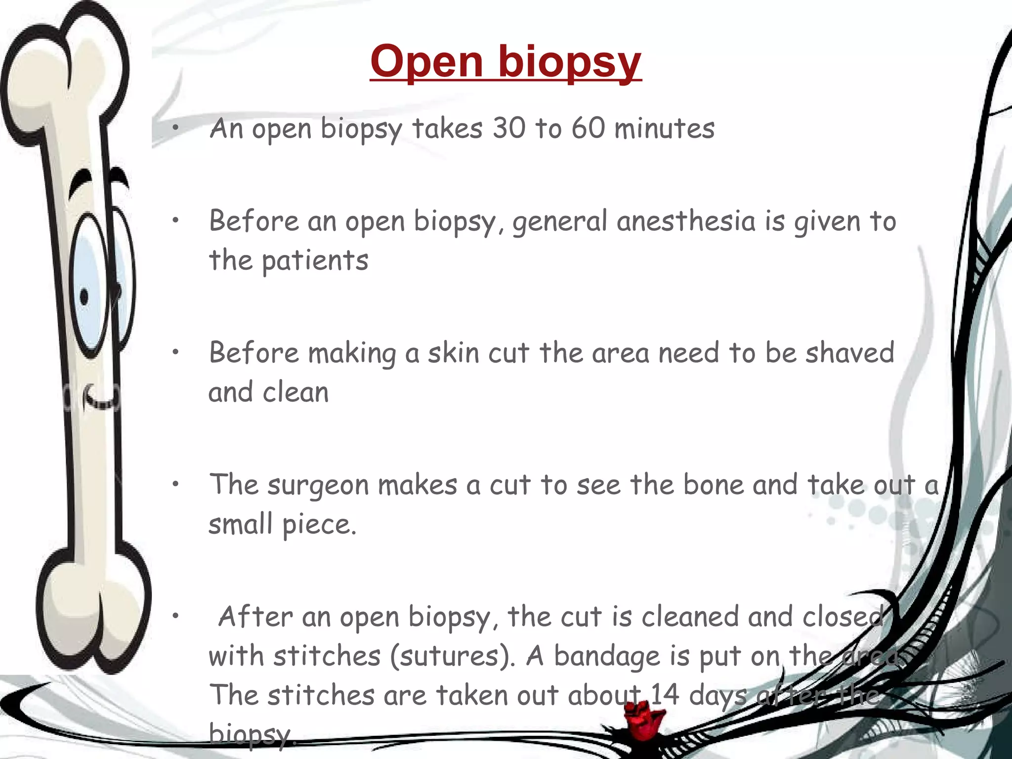Bone Biopsy And Its Decalcification | PPT