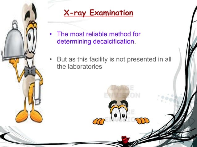 Bone Biopsy And Its Decalcification | PPT | Bone and Joint Conditions | Diseases and Conditions