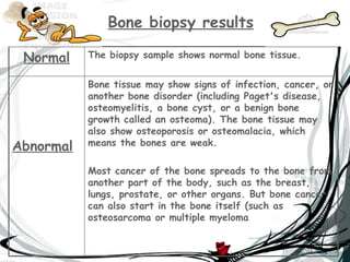 Bone Biopsy And Its Decalcification | PPT