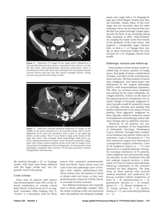 Musculoskeletal Cancer Surgery | PDF
