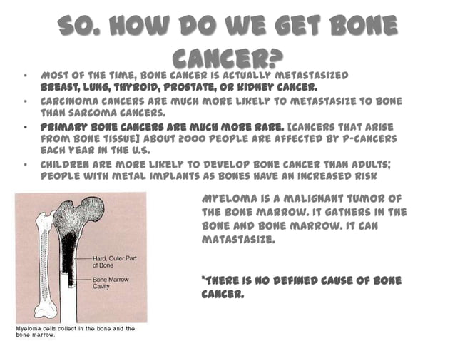 Bone cancer | PPT