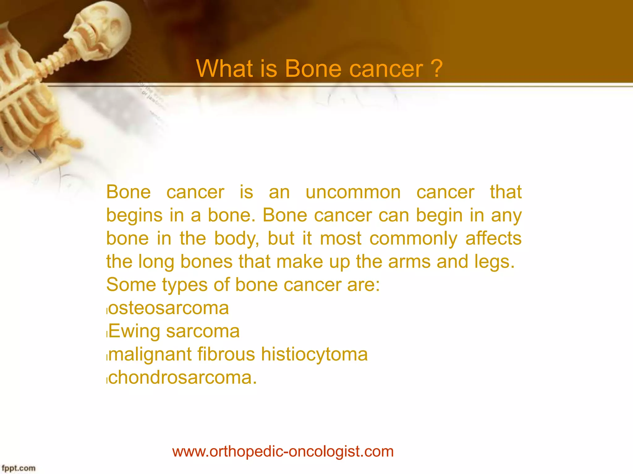 Bone cancer | PPTX