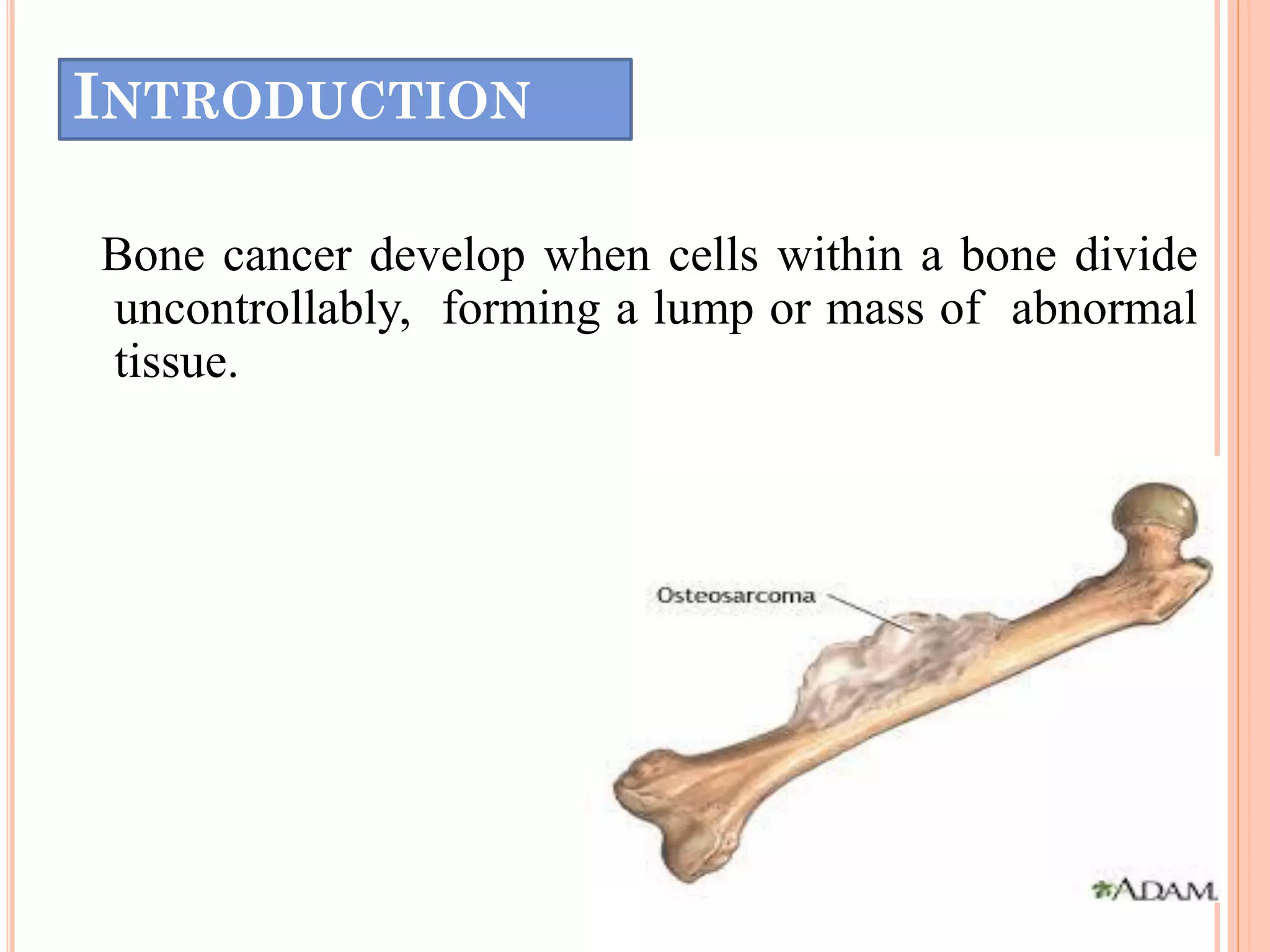 Bone cancer | PDF