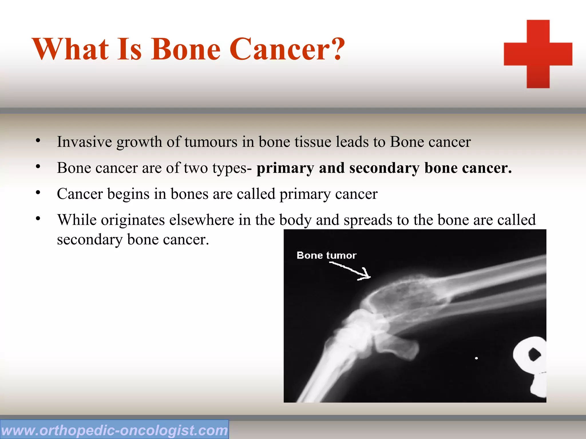 Bone cancer ppt | PPT