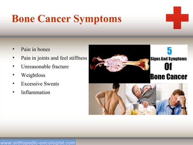 Bone cancer ppt | PPT
