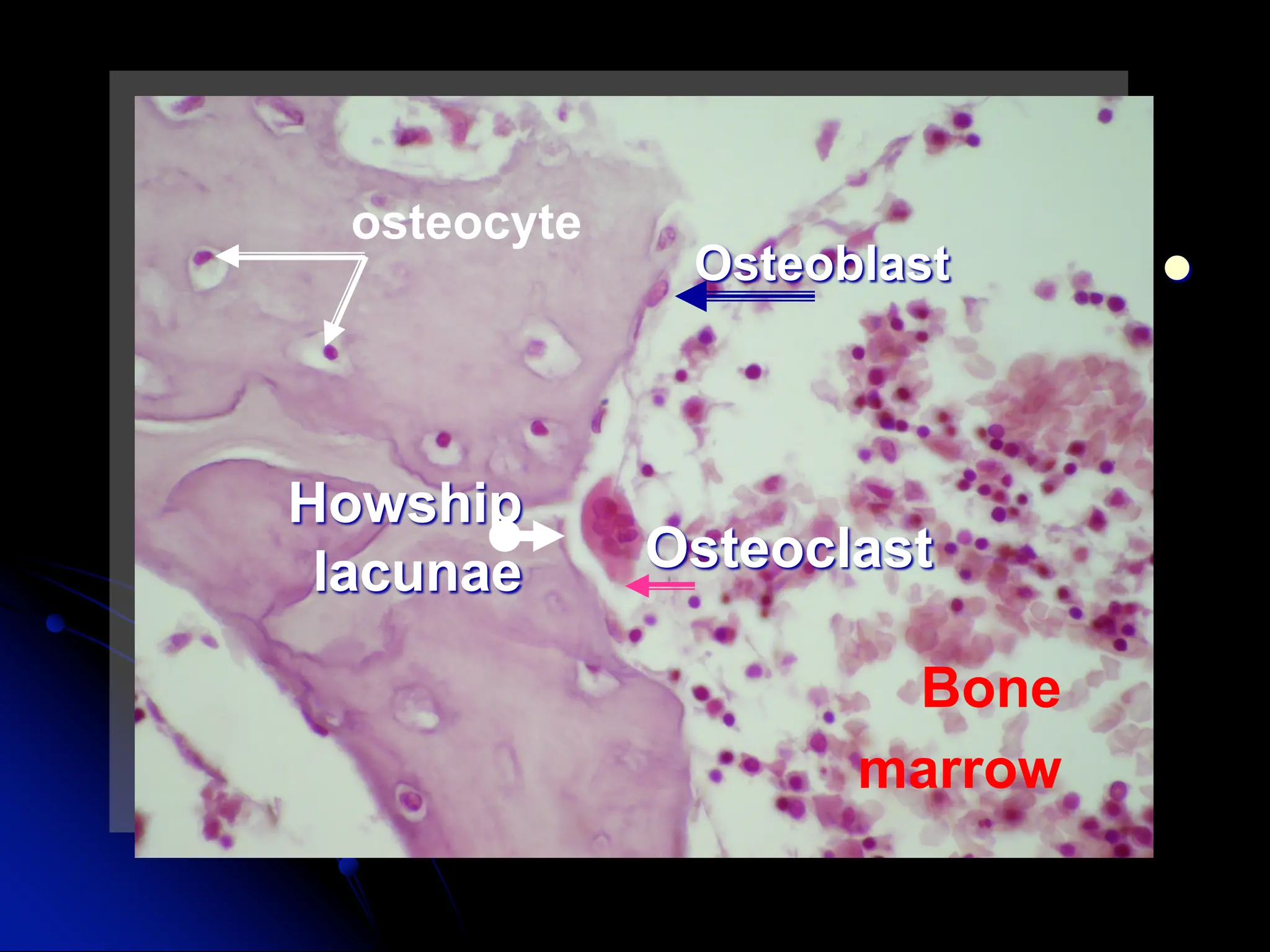 Bone cartilage lab.pdf histology first year | PDF | Death, Injury, or ...