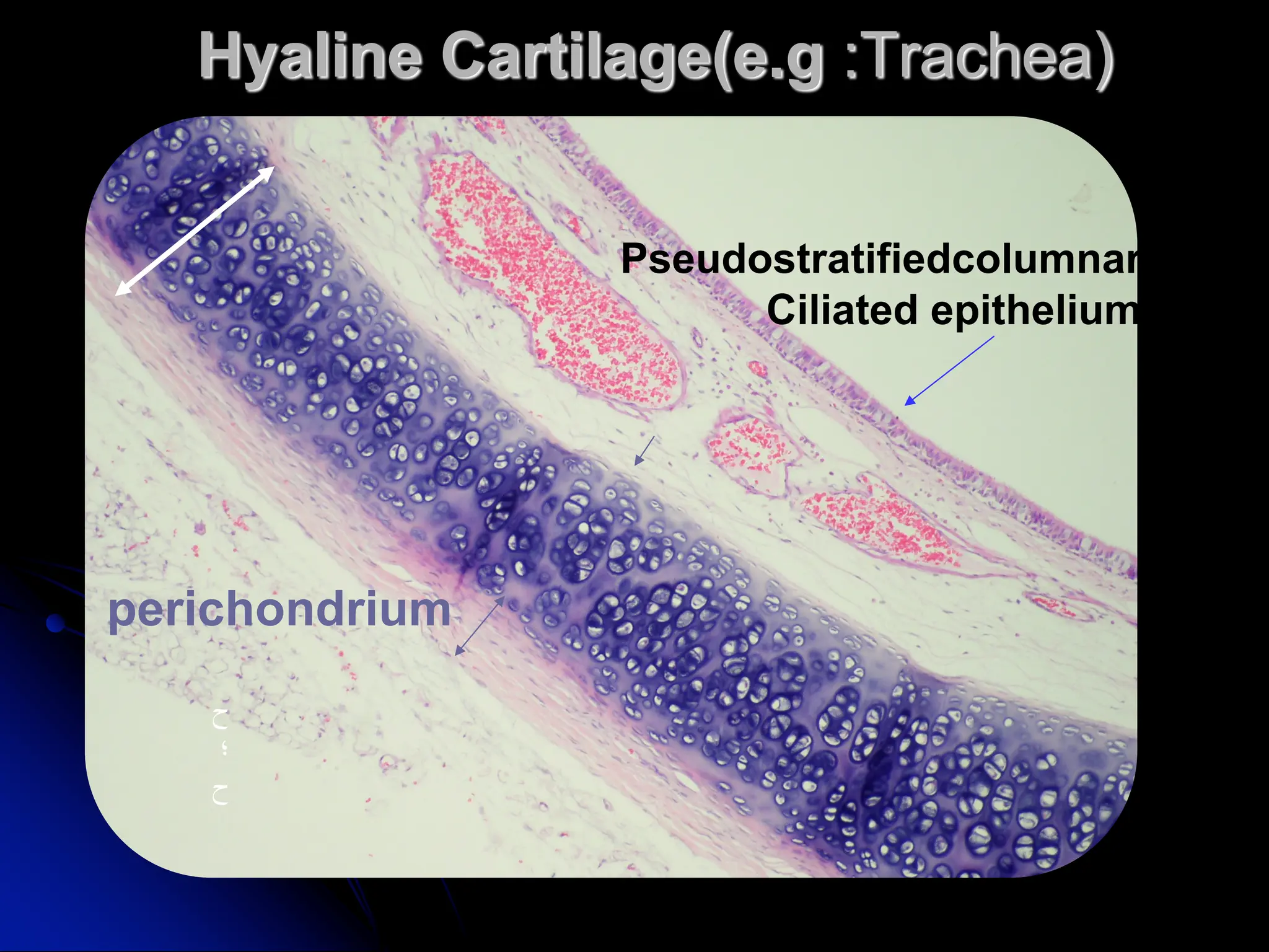 Bone cartilage lab.pdf histology first year | PDF | Death, Injury, or ...