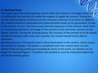 Bone cement | PPTX