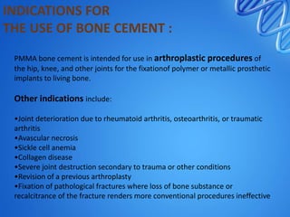 Bone cement | PPTX