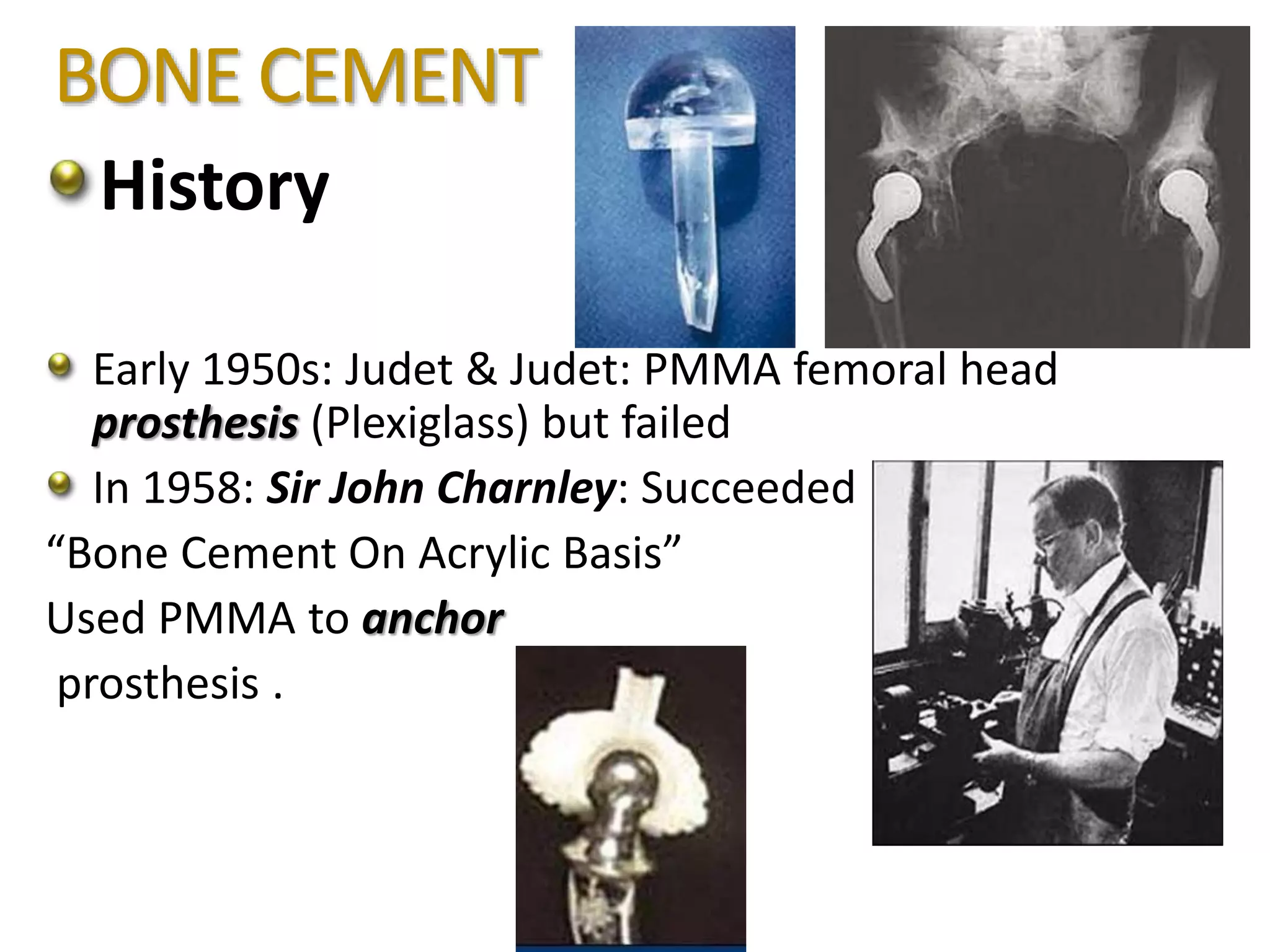 Bone cement | PPTX