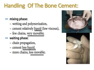 Bone cement | PPTX