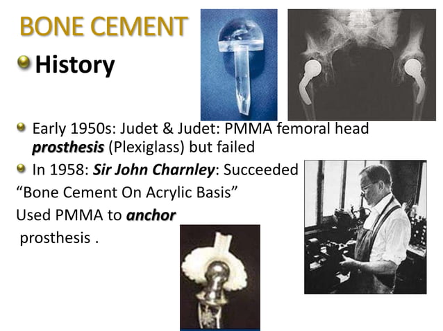 Bone cement | PPTX | Bone and Joint Conditions | Diseases and Conditions
