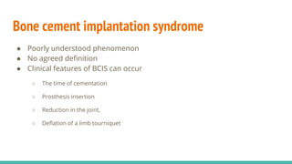 Bone cement | PPTX
