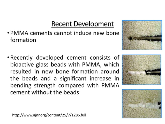 Bone cement | PPT