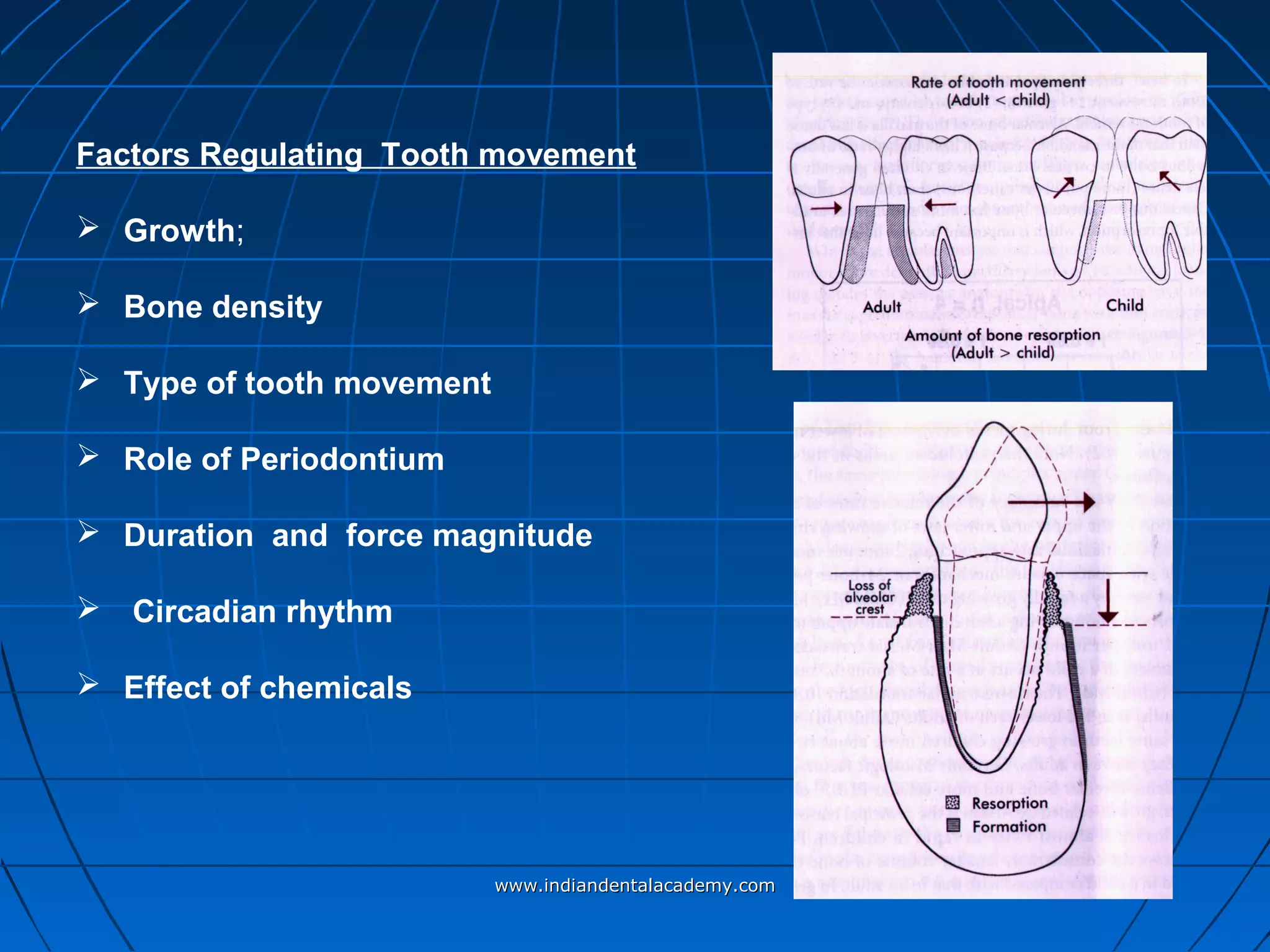 Bone changes during ortho. tooth movement | PPT