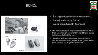 Bone Conduction Hearing Devices(BCHDs) | PPTX