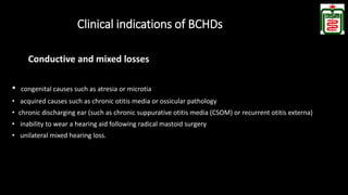 Bone Conduction Hearing Devices(BCHDs) | PPTX | Digital Audio ...