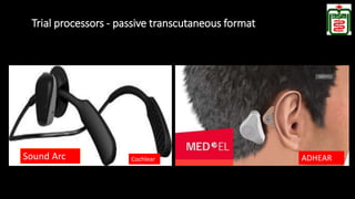 Bone Conduction Hearing Devices(BCHDs) | PPTX | Digital Audio ...