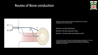 Bone Conduction Hearing Devices(BCHDs) | PPT