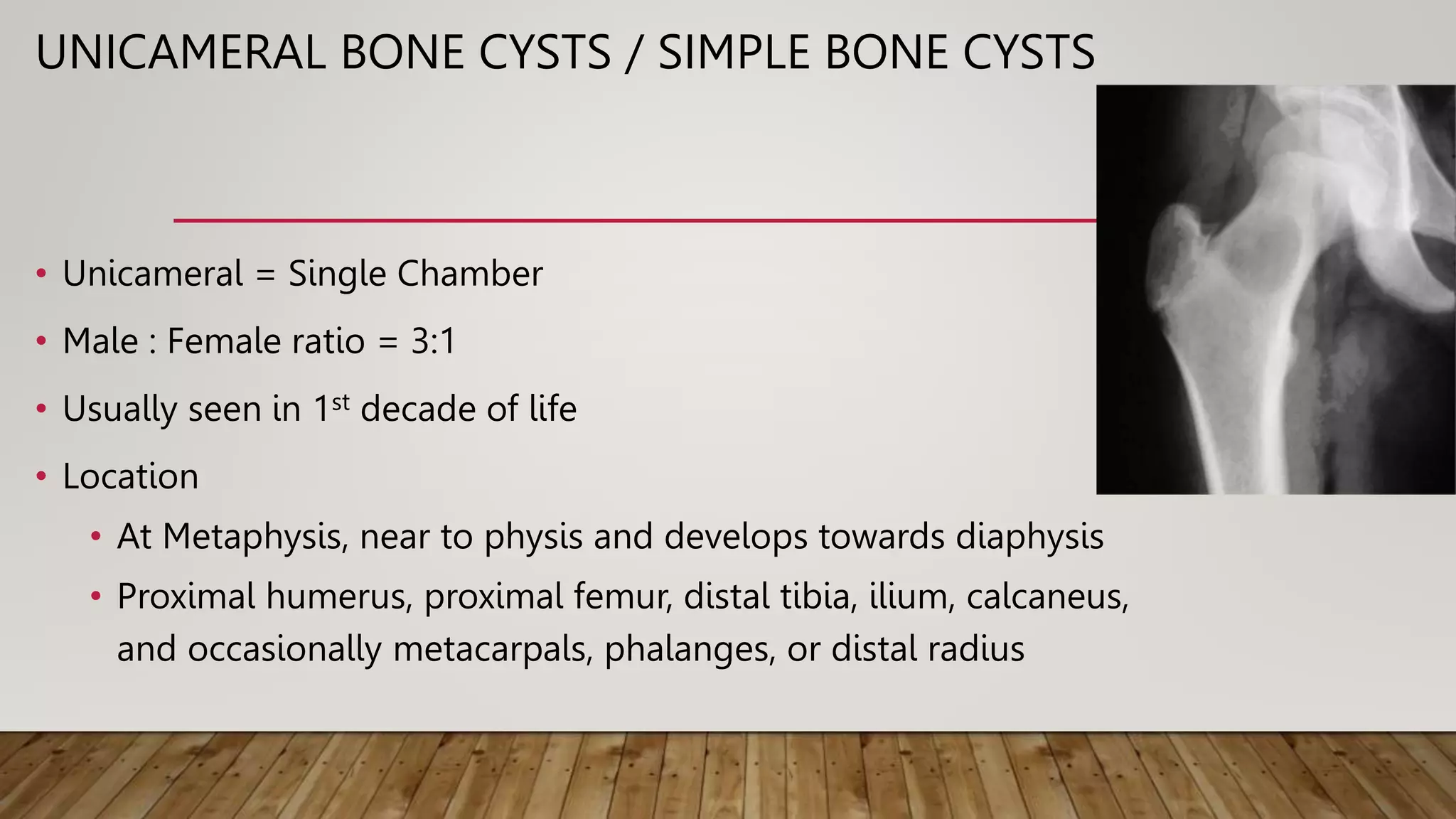 Bone Cysts in Children.pptx