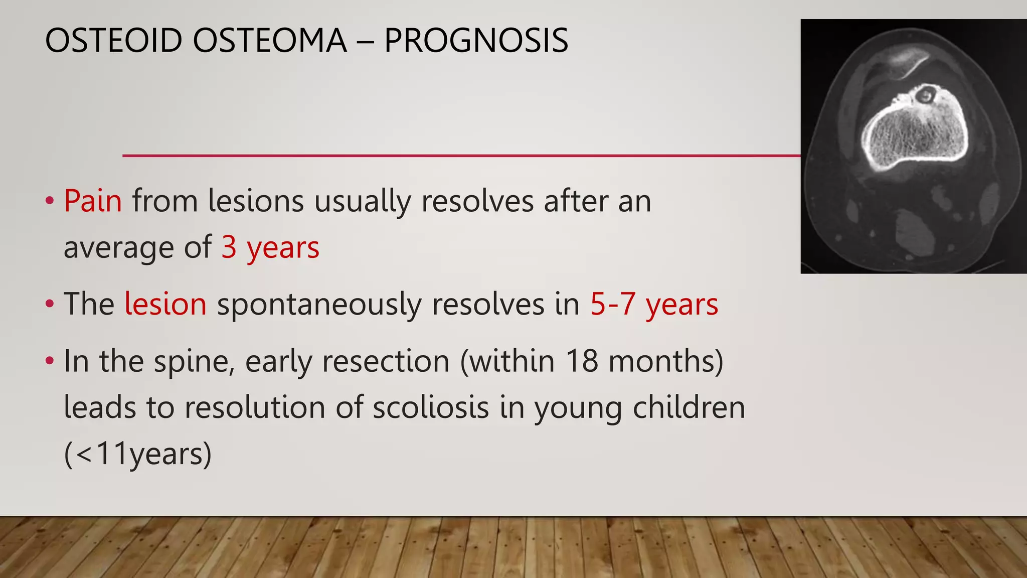 Bone Cysts in Children.pptx