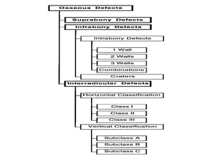 Bone Defects in different Periodontal disease.pptx | Bone and Joint ...