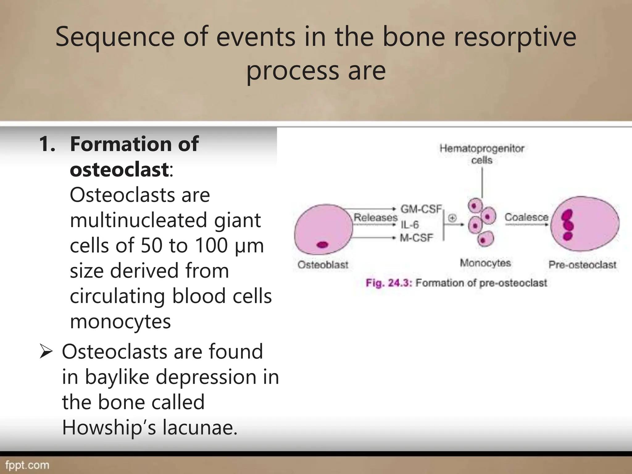 BONE DEFECTS lecture in periodontology. | PPTX