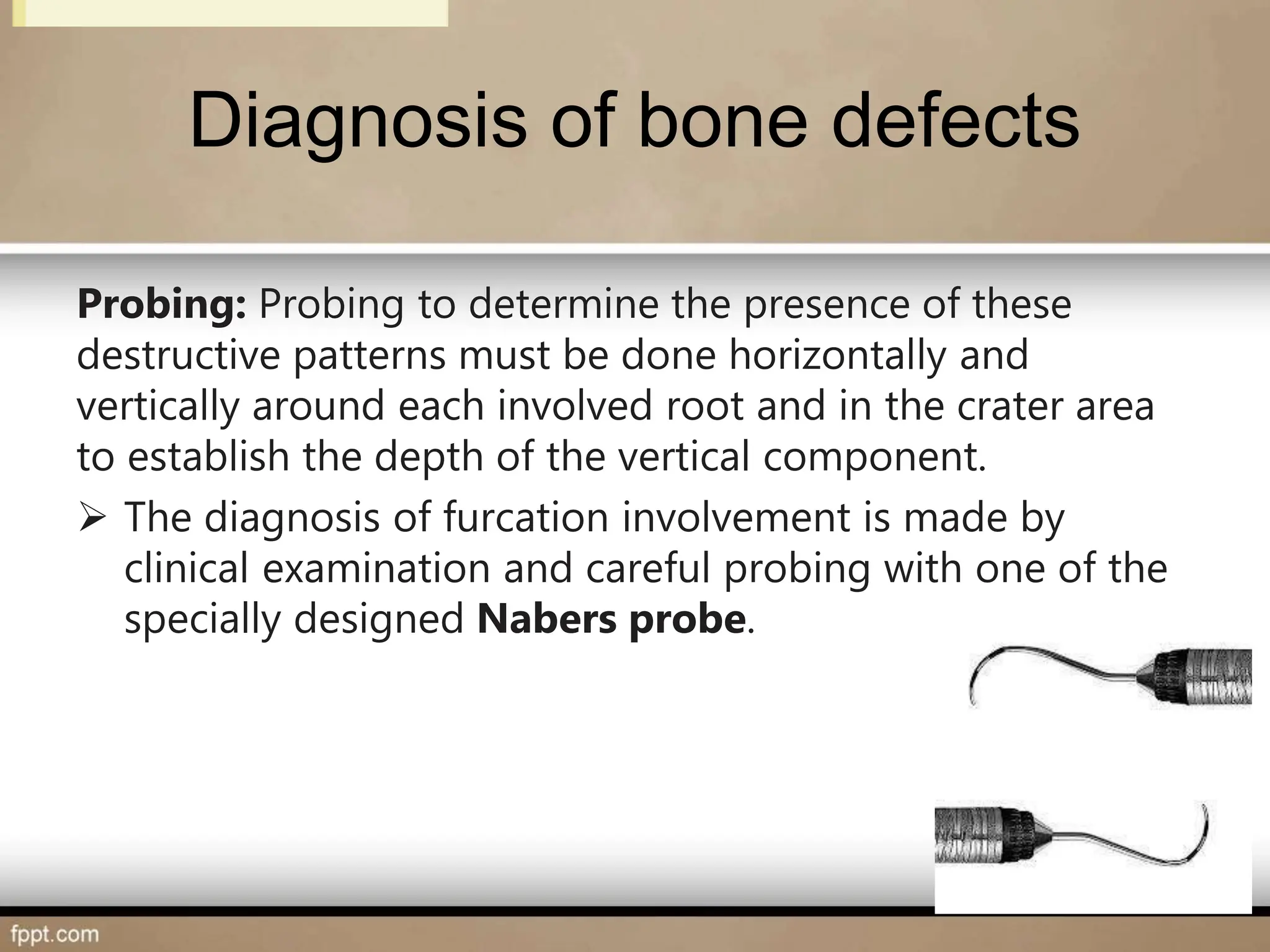 BONE DEFECTS lecture in periodontology. | PPTX