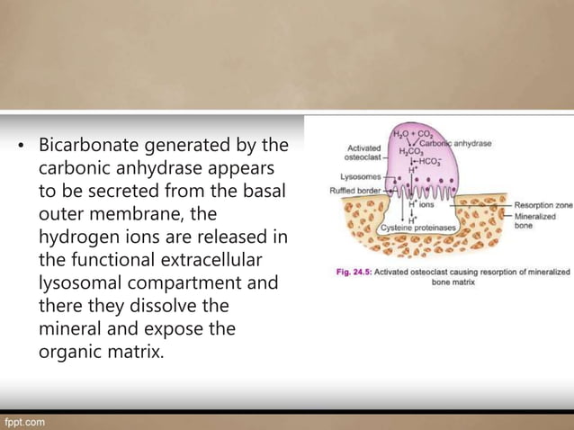 BONE DEFECTS lecture in periodontology. | PPTX | Dental Health ...