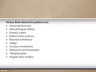 BONE DEFECTS lecture in periodontology. | PPTX