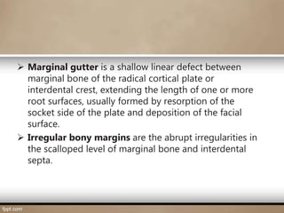 BONE DEFECTS lecture in periodontology. | PPTX
