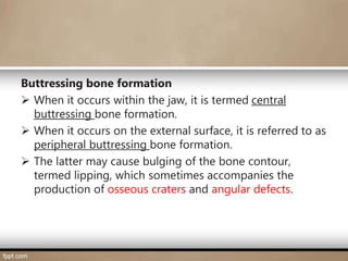 BONE DEFECTS lecture in periodontology. | PPTX