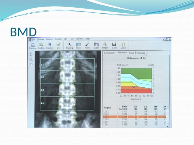 bone densitometry in orthopedic clinical practice.pptx