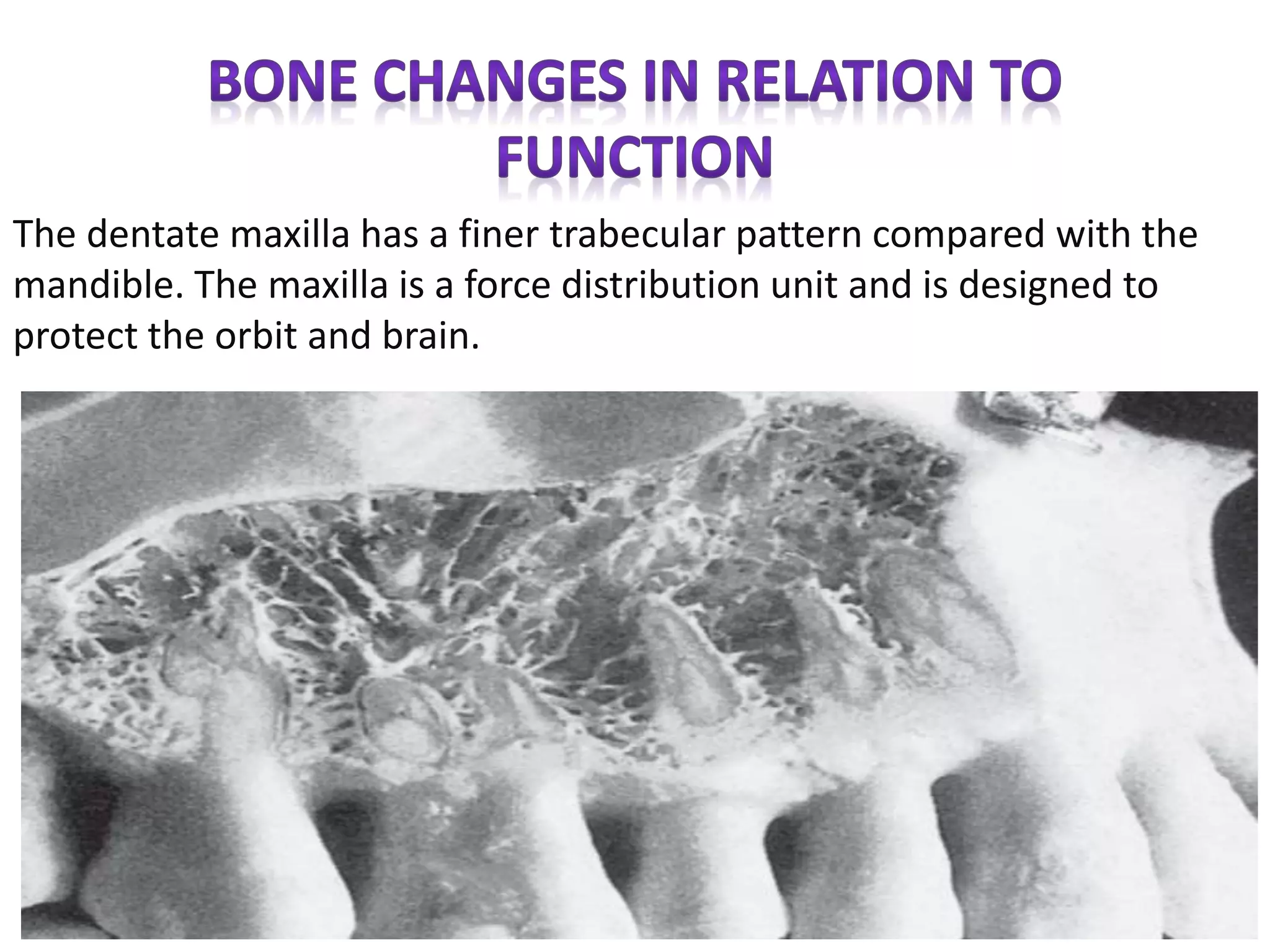 Bone density for dental implant. | PPTX