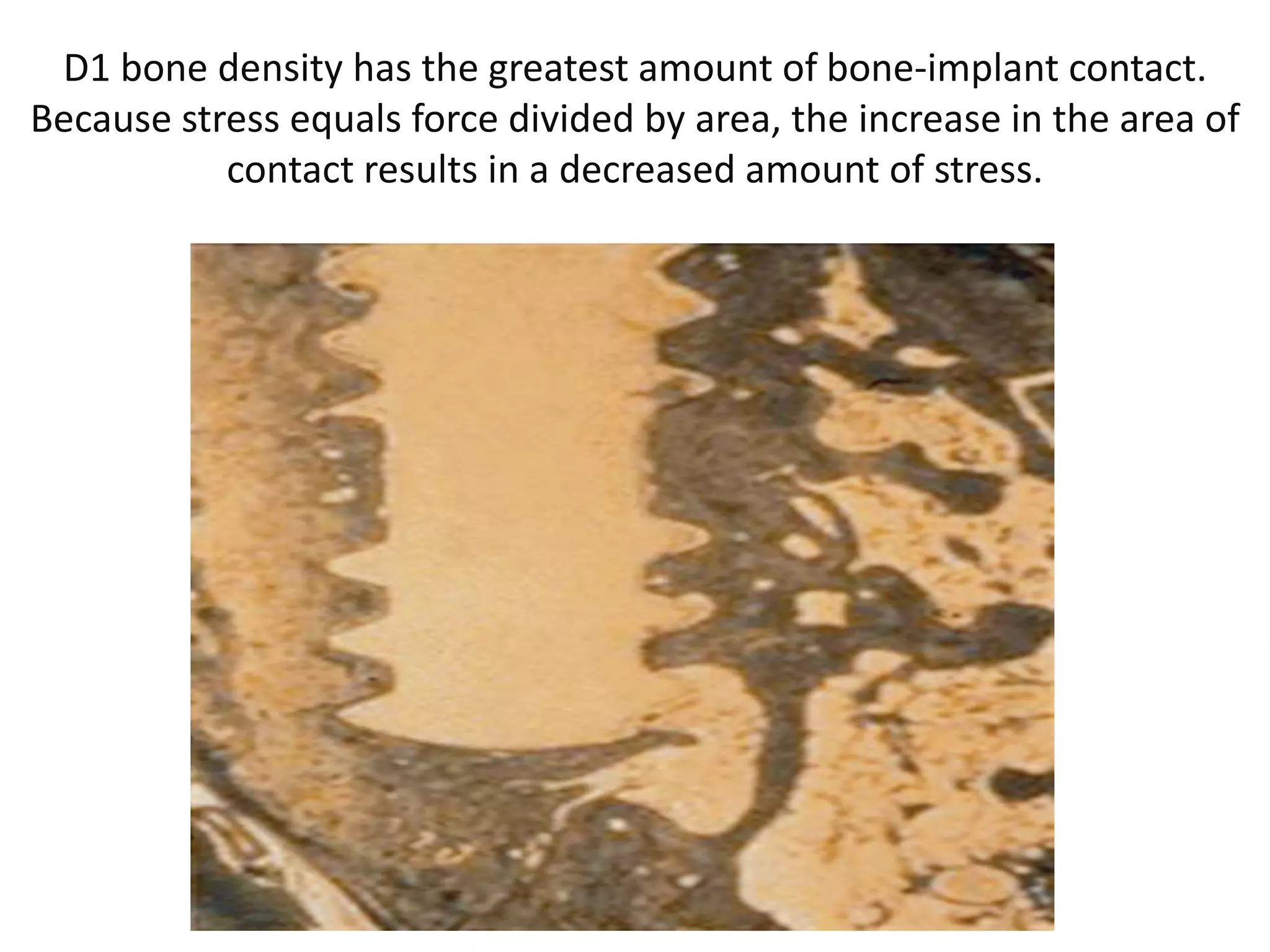 Bone density for dental implant. | PPTX