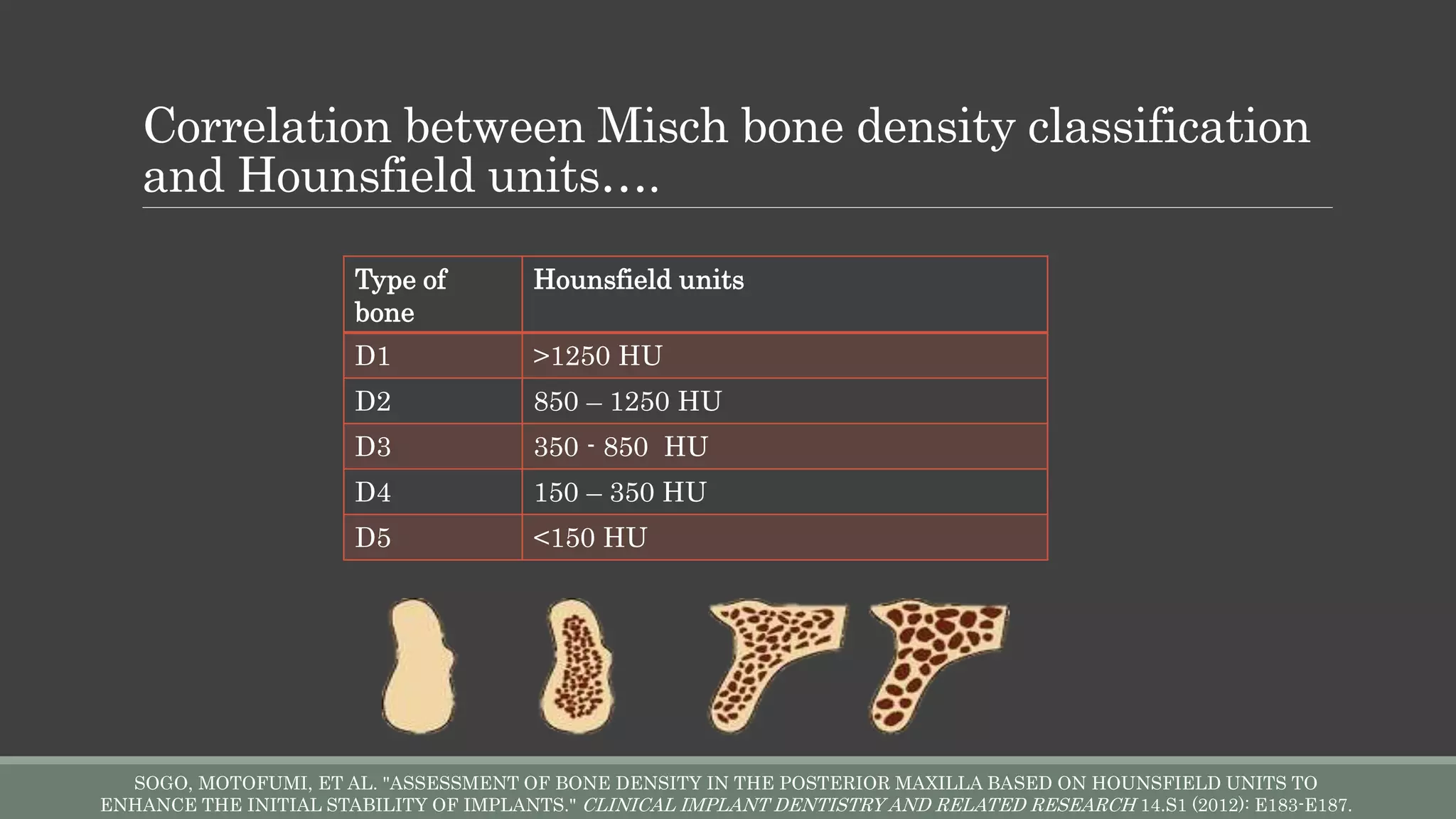 Bone density ppt