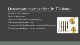 Bone density ppt | PPTX