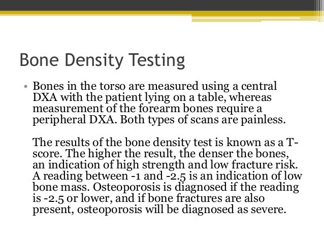 Bone Density Testing: Purpose and Procedure
