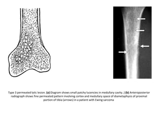 Bone disease imaging for students 2012 part2 | PPT