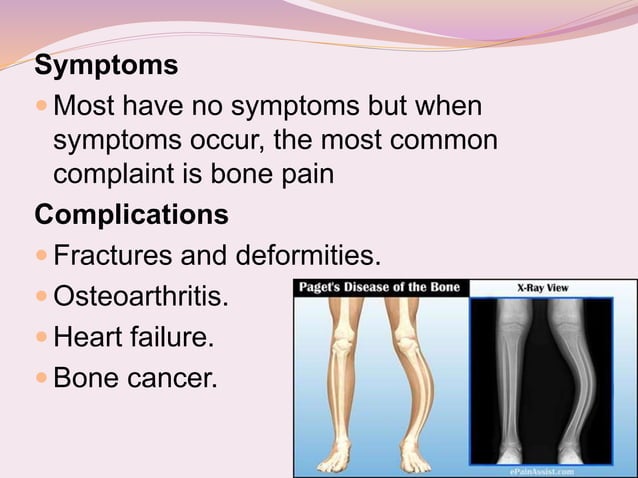 bone DISEASES.ppt