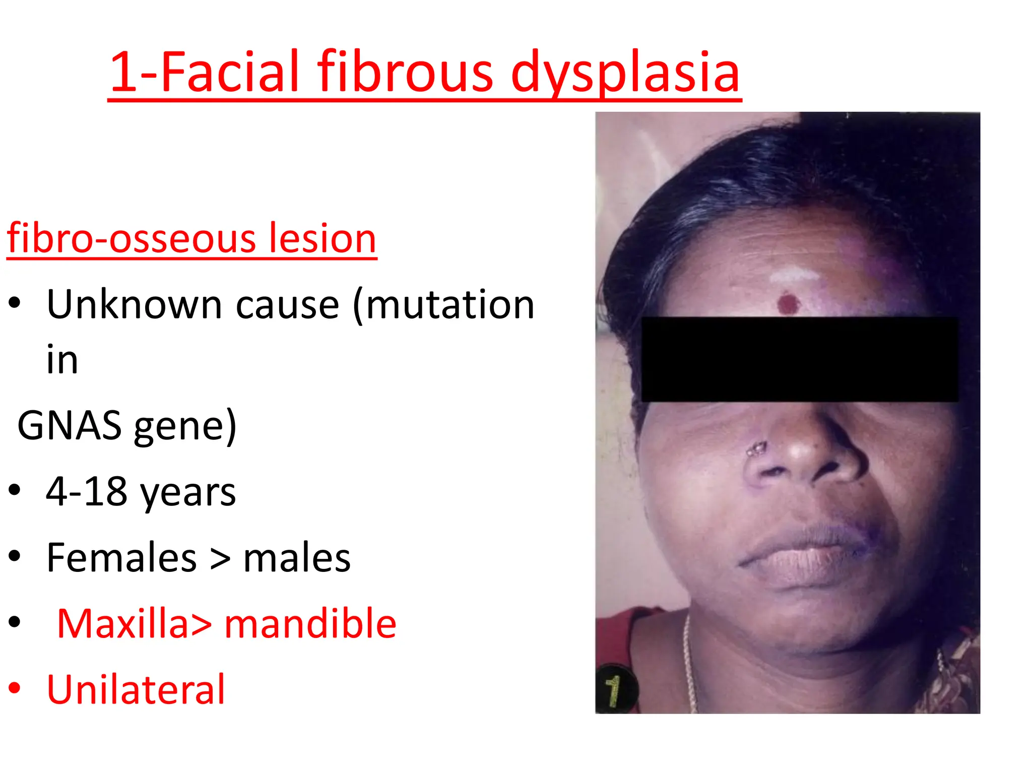 bone diseases I&II Dr Reham (1).pd vvvvf | PDF